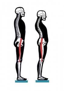 Running Injuries:IT Band and the TFL