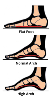 Plantar Fasciitis & The Pain In Your Foot | CoreWalking